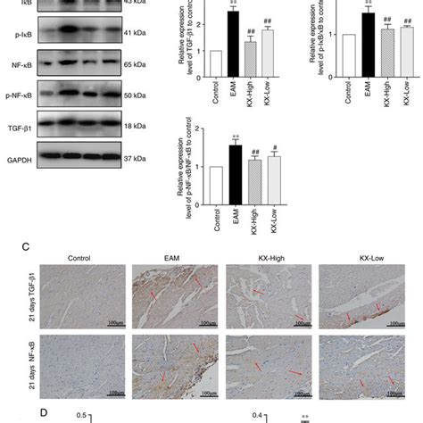 Effects Of Kx On Tab1 And Nf κb Signaling In The Mouse Myocardium A
