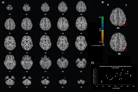 Figure 4 From Developmental Specialization Of The Left Parietal Cortex