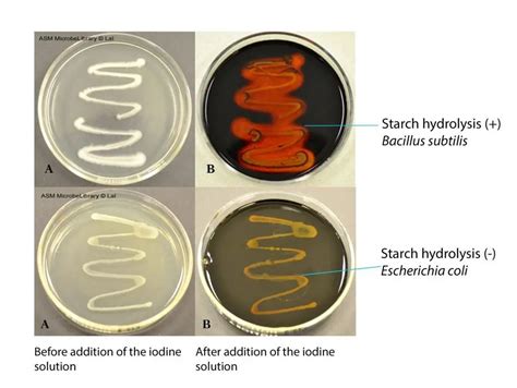 4 Types Of Bacteria