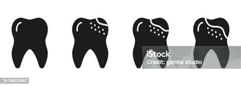 교정 치아 문제 치아 우식증 프로세스 실루엣 아이콘 세트입니다 치과 치료 기호입니다 치아 질환 단계 글리프 픽토그램 치과 솔리드 기호입니다 고립된 벡터 그림 건강 진단에