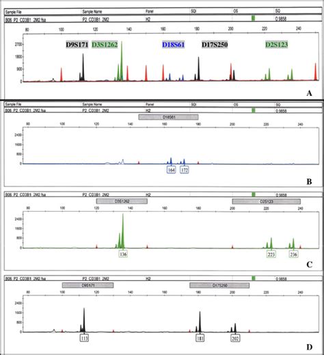 Electropherograms Of Group Ii Markers The X Axis Represents Dna