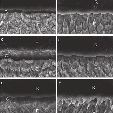 Cross Sectional Electron Micrographs Of Bonded Enamel Specimens Download Scientific Diagram