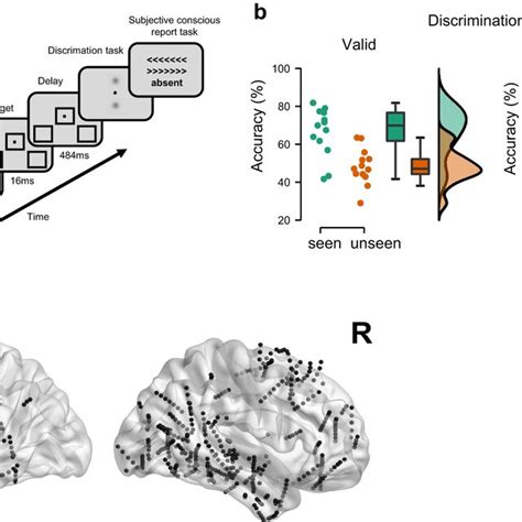 Fp White Matter Tracts Connecting Contacts In The Right Download
