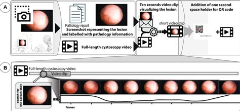 Workflow Of The Framework For Visual Documentation Of Cystoscopy A A Download Scientific