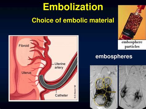 Ppt Lower Gastrointestinal Bleeding Powerpoint Presentation Free Download Id 5040268