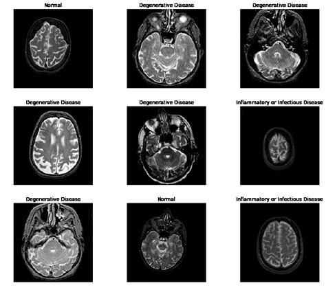 Sample Harvard Whole Brain MRI Dataset Southern Medical University