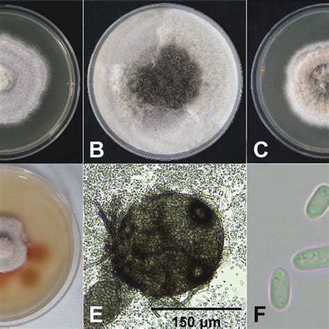 Cultural And Morphological Features Of Phoma Sp Isolate From Tomato Download Scientific