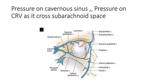 Optic Nerve And Pupil Tutorial Pptx