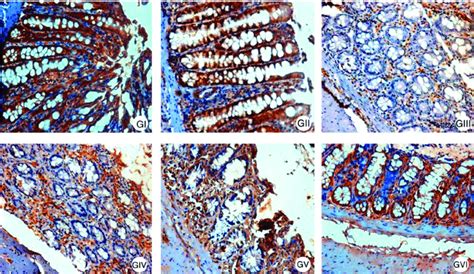 Immunohistochemical Staining For P53 20x Objective Brown Colour
