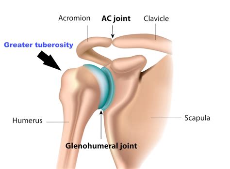 Greater Tuberosity Fractures Causes And Management