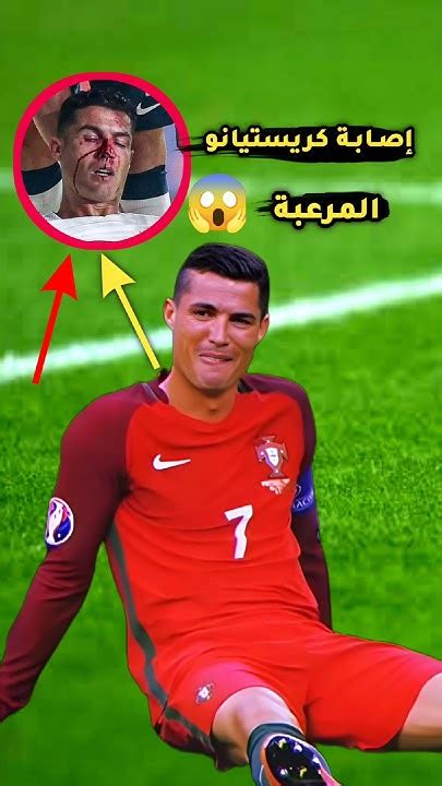 إصابة كريستيانو رونالدو التي ارعبت العالم 😱 كريستيانو رونالدو النصر