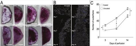 Scaffold Cellularization By Perfusion Bioreactor Based Seeding A Download Scientific Diagram