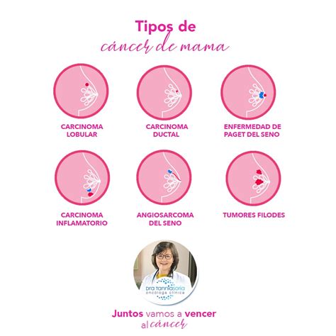 Sintomas Do Câncer De Mama Sintomas E Diagnóstico Precoce Do Câncer