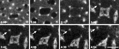 Alternative Pathway For The Formation Of Multipolar Spindle Arrays