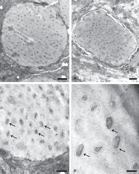 Spheroids Of It Epv From I Typographus Under Tem Microscope Bars A