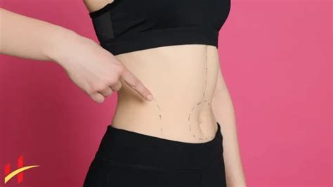 Lisa Marie Presley Bariatric Surgery Health Fitness Future