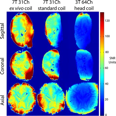 Signal To Noise Ratio SNR Analysis Of Coil Performance Download Scientific Diagram