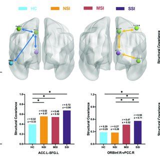 Comparison Of CON Structural Covariance Network Left Side Compared
