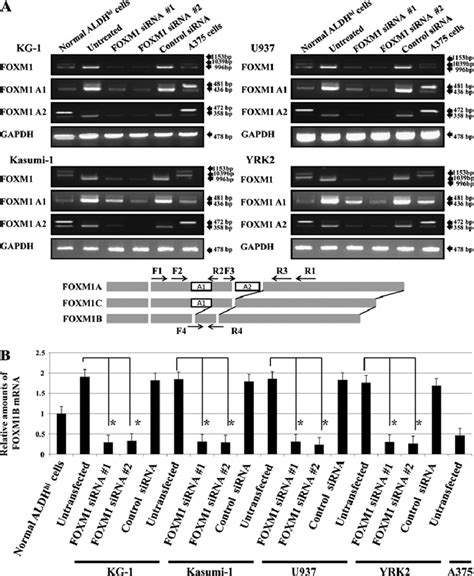 Foxm1 Mrna Expression In Leukemia Cells A Rtpcr Analysis Of The