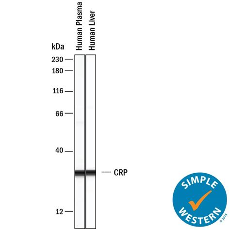 Detection Of Human C‑reactive Protein Crp By Simple Westerntm