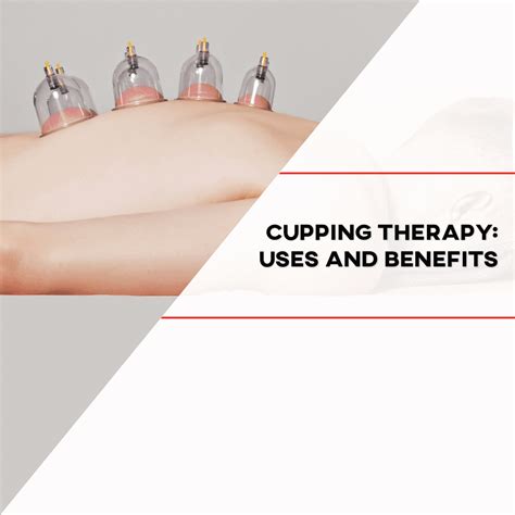 Cupping Therapy Uses And Benefits [p]rehab