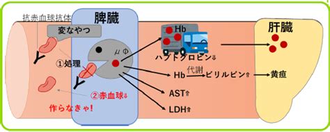 貧血の全体像を分かりやすく解説薬剤師国家試験対策 マインドマップ薬学