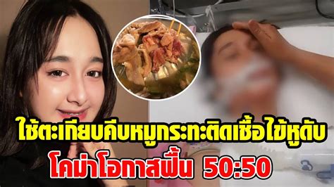 อุทาหรณ์ คนชอบกินหมูกระทะ ใช้ตะเกียบคีบหมูกระทะทำติดโรคไข้หูดับ สาววัย