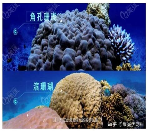 卡洛尔邦珊瑚骨 珊瑚骨填充法令纹要多少钱一克，和爱贝芙等长效填充材料比哪个价格贵？ 知乎