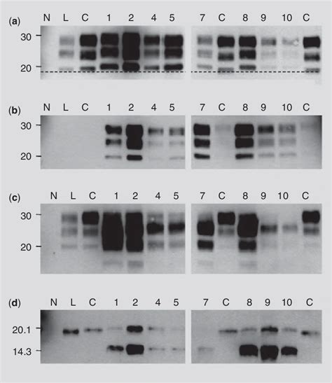 21 Biochemical Typing Of Different Brain Regions In H Type Bse