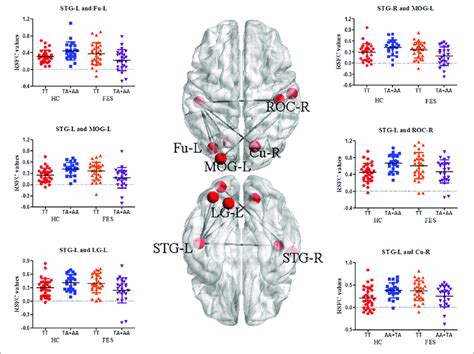 RSFC Analysis Between Different Functional Network Points In The Download Scientific Diagram