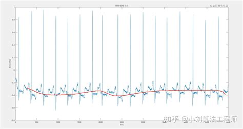 「ecg信号处理 第六课——（1）基线漂移去噪与实现方法（高通滤波器）」2025年1月7日 知乎