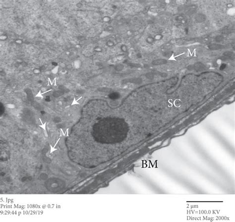 Electron Micrographs Of A Seminiferous Tubule Of A Control Rat A