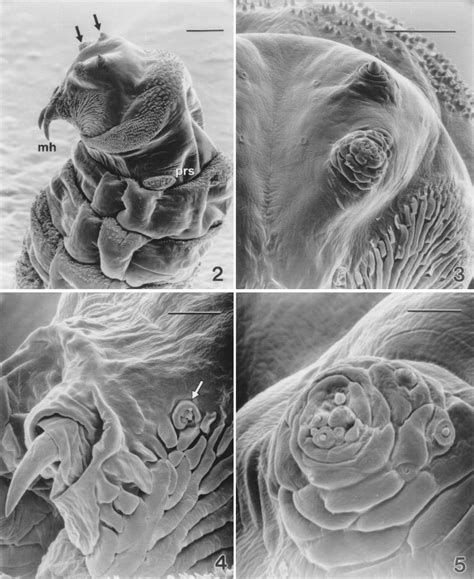 Low MagniÞcation Scanning Electron Micrograph Of The Cephalic Segment