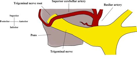 Trigeminal Nerve Anatomy Ppt Trigeminal Nerve Ppt