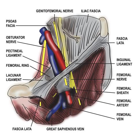 Femoral Sheath