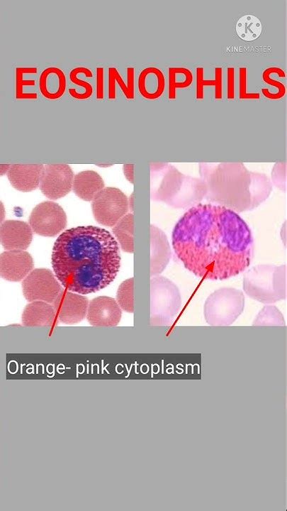 Eosinophil Identification Youtube