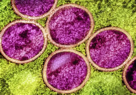 Mpox Virus Particles Tem Stock Image C0579489 Science Photo Library