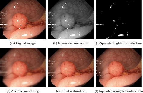 Uit Saviors At Medvqa Gi Improving Multimodal Learning With Image