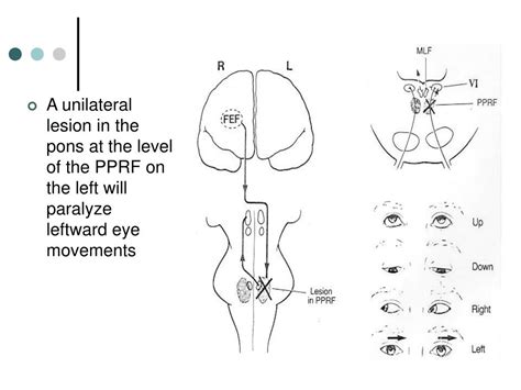 Ppt Eye Movement Disorder Powerpoint Presentation Free Download Id3336024