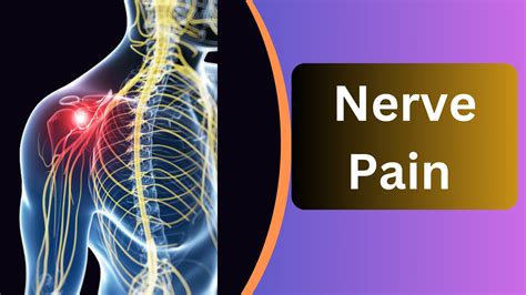 Nerve Pain Neuropathic Pain Causes Treatment And Symptoms