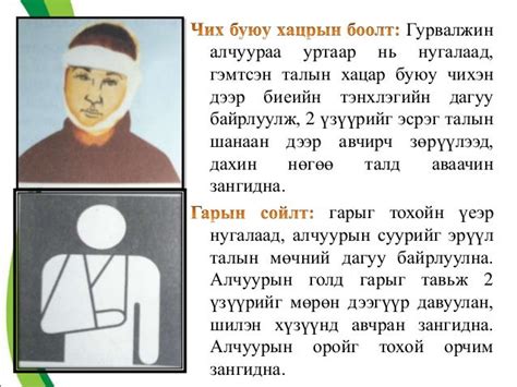 Анхны тусламж үзүүлэх семинар О Батбаяр