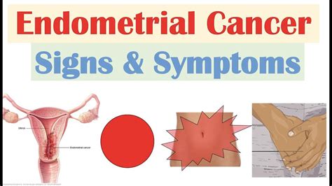 Endometrial Cancer Signs And Symptoms And Why They Occur