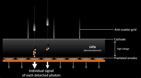 Photon Counting Detectors Concept Technical Challenges And Clinical Outlook European