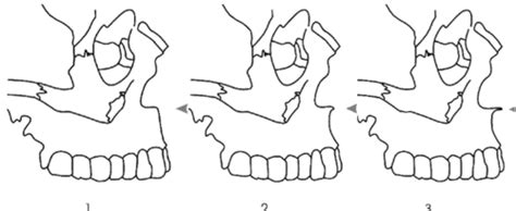 Chapter 9 Ancestry Estimation Flashcards Quizlet