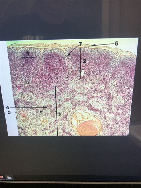 Slides For Lymphatic System Diagram Quizlet