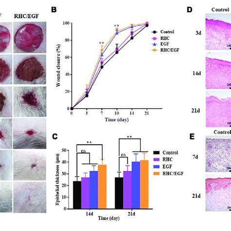 Immunohistochemical Examination Of Cd31 And Vegf Expression A