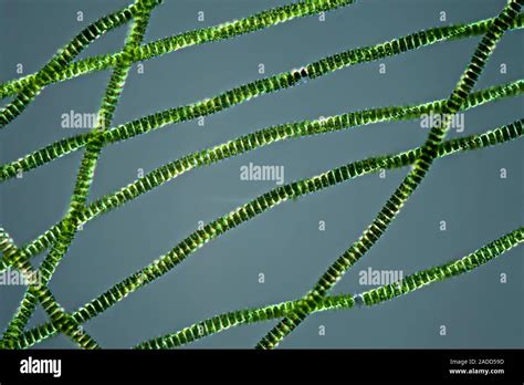 Light Micrograph Of Desmidium Swartzii Freshwater Filamentous Green