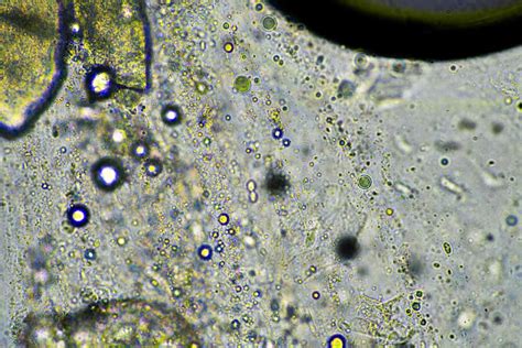 Premium Photo Green Mucus And Coughing Up Phlegm Under The Microscope