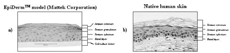Histology Of A Epiderm Tm Model From Mattek And Download