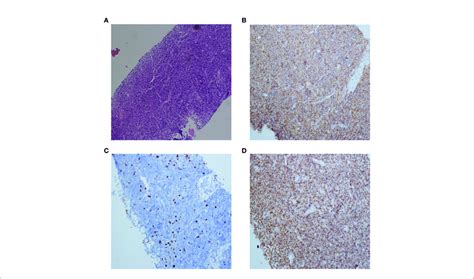 Histopathology And Immunohistochemistry Ihc Of The Lymph Node Of